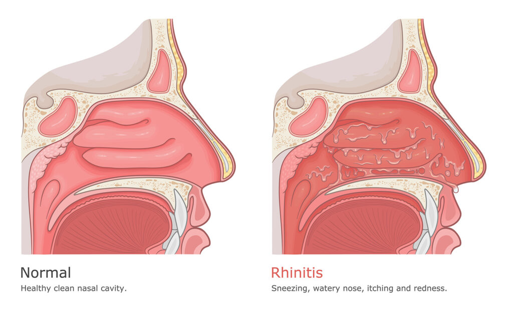 Can Your Hearing Loss Be Corrected with Surgery?